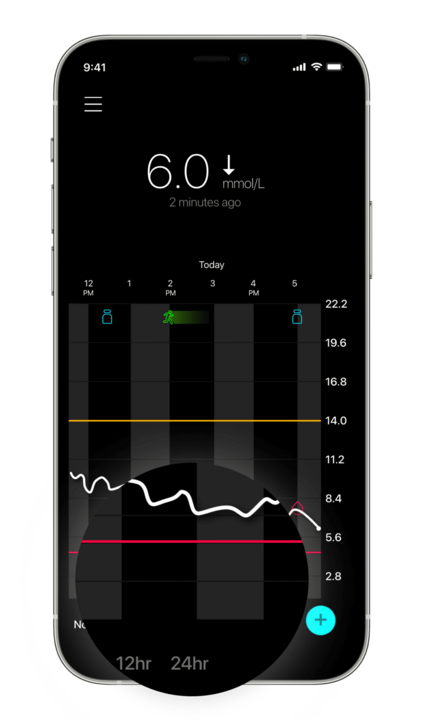 Guardian™ 4 pametni CGM sustav | Medtronic Diabetes Croatia