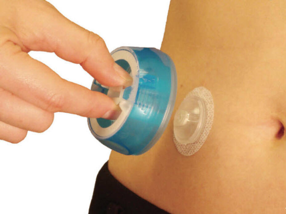 I-PORT ADVANCE™ WHO KNEW SOMETHING SO SMALL COULD MAKE SUCH A BIG ...