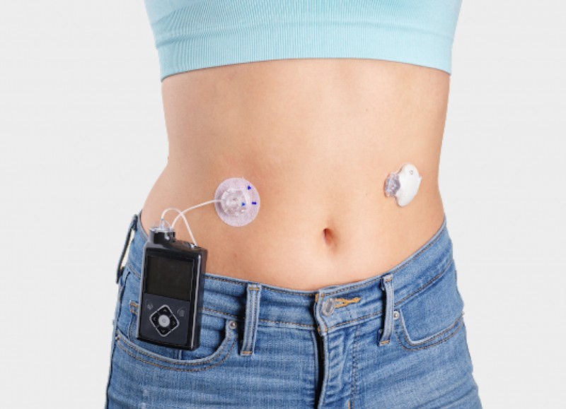 Scii To Sap Uk Medtronic Diabetes